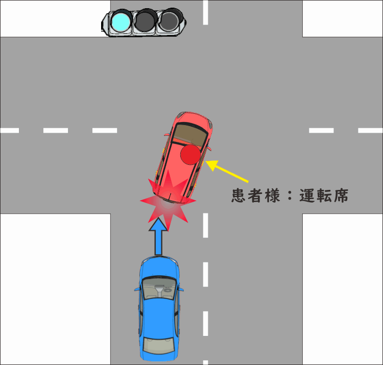 交通事故17 】右折するため交差点内で停車中、後方から追突された。 八王子・みどり堂整骨院